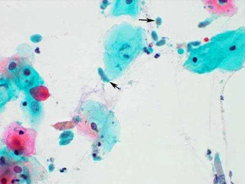 What is an STI or Sexual Transmitted Infection? @ Women on Waves